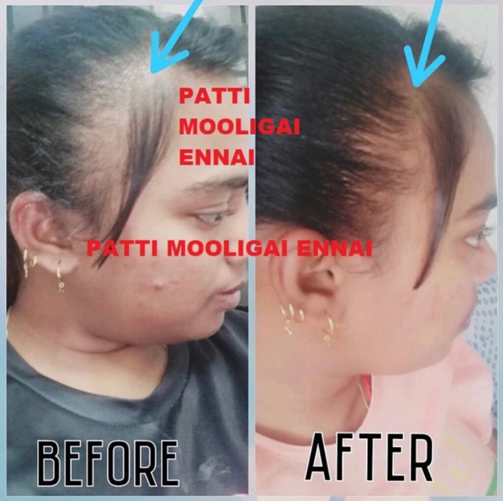 Patti Mooligai Adult Hair Oil Set Plus Hair Root Tonic - Patti Mooligai